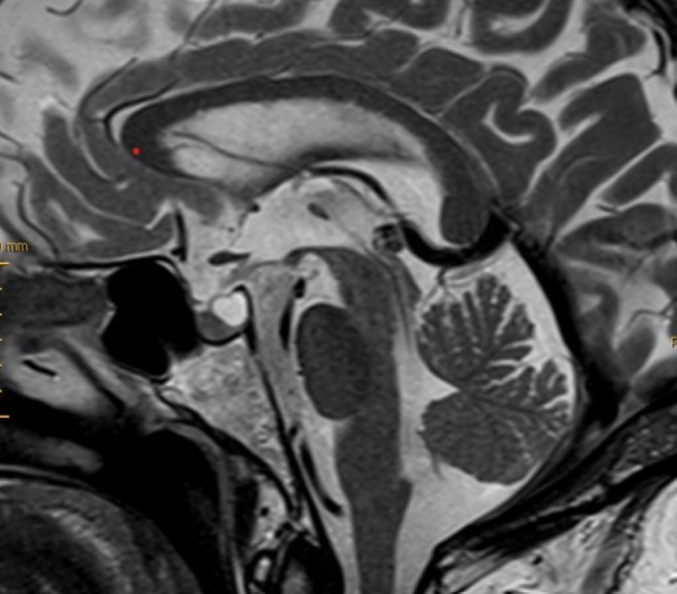 MRT Kopf: Ablauf, Vorbereitung, Kosten