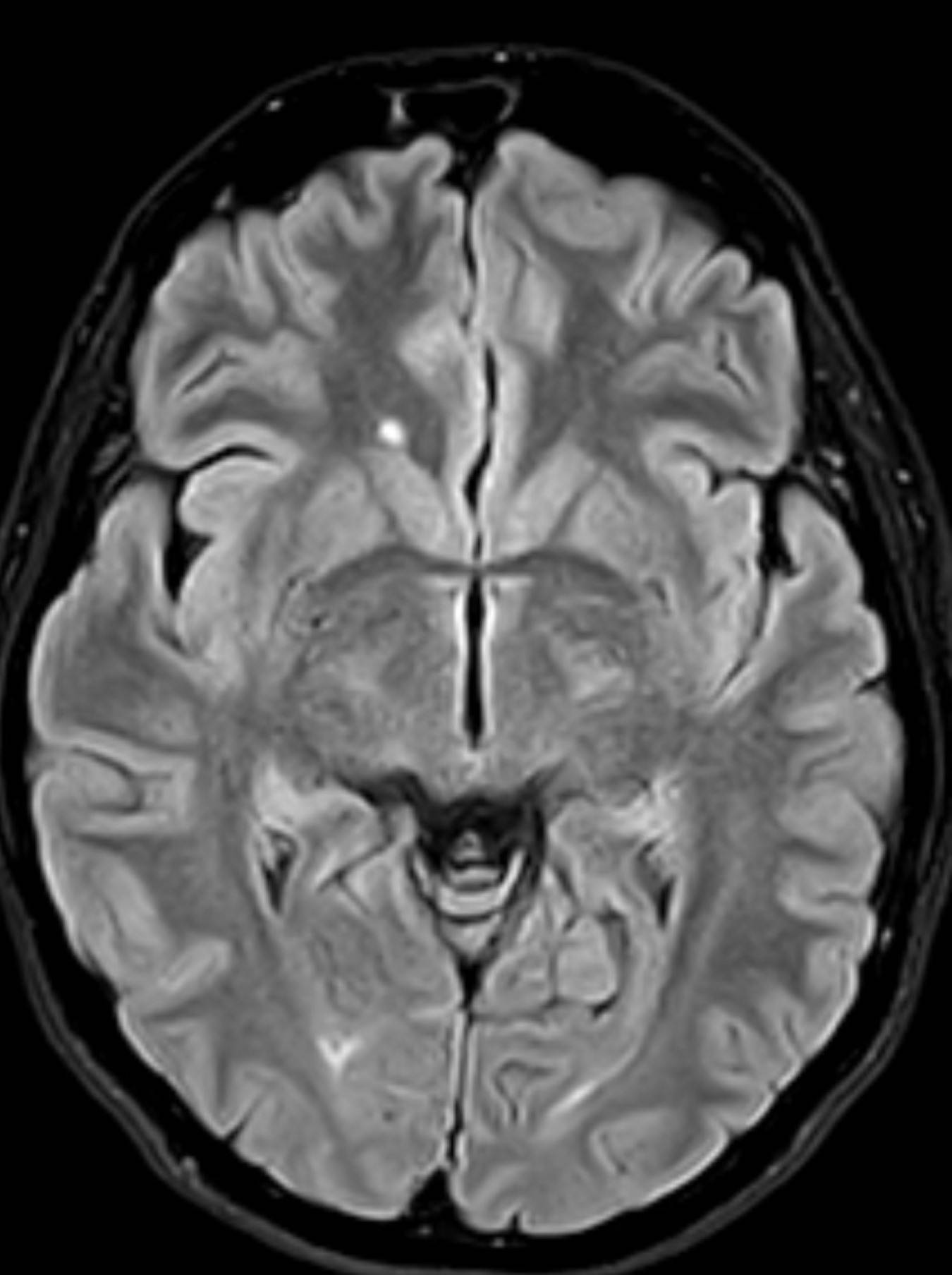 MRT Kopf: Ablauf, Vorbereitung, Kosten