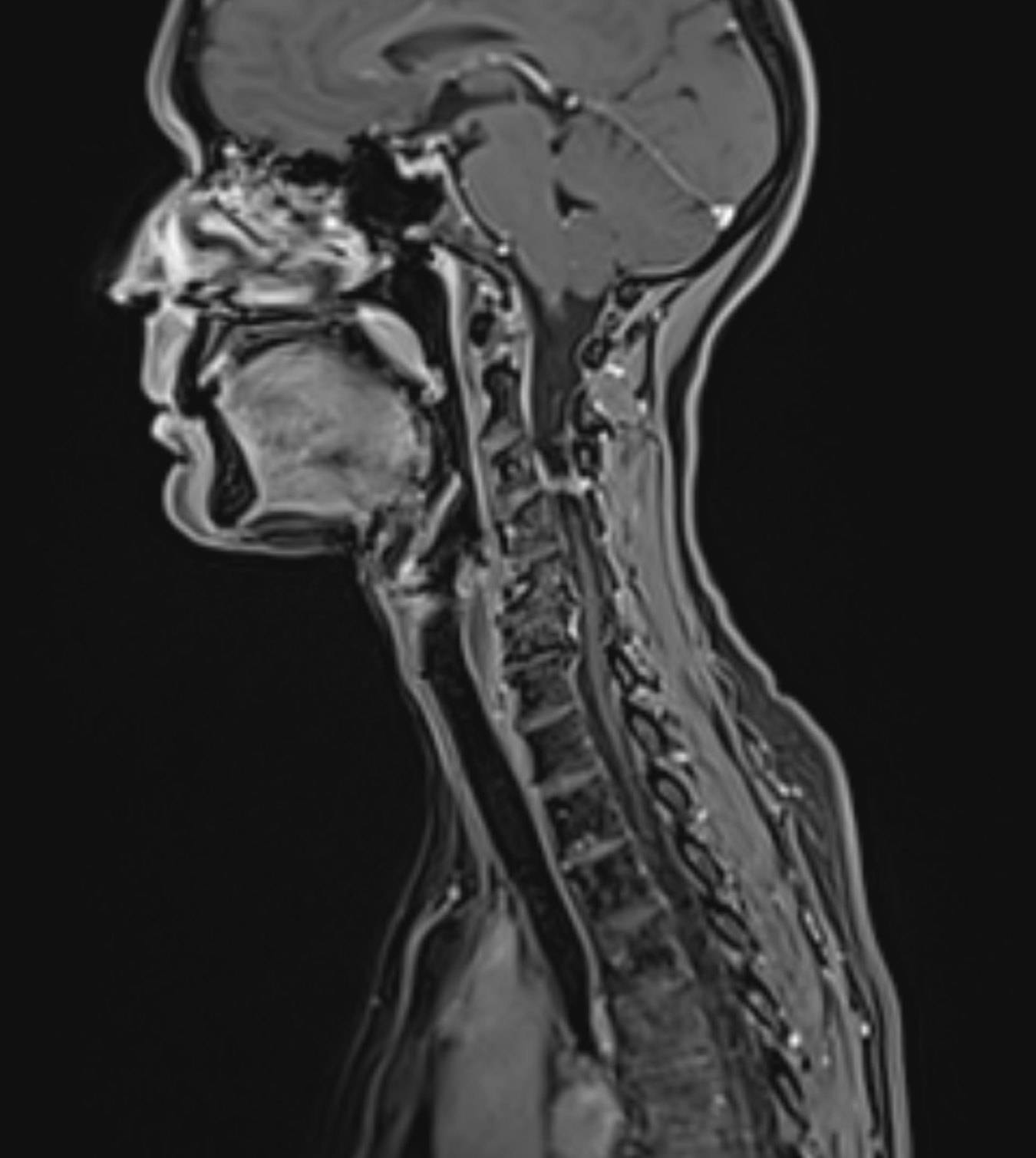 MRT Kopf: Ablauf, Vorbereitung, Kosten